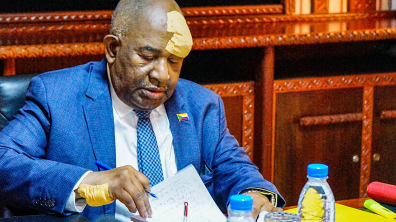 Ce que l’on sait de l’attaque au couteau contre Azali Assoumani