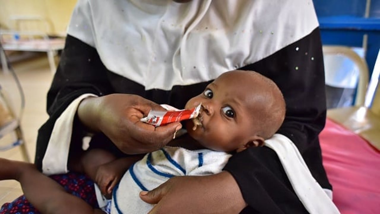 Au Niger, la STA se veut en pointe contre la malnutrition